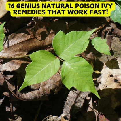 16 Simple, Effective, and Natural Poison Ivy Remedies